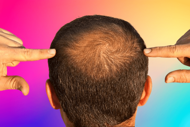 Fighting Hair Loss? Discover the Path to Stronger Hair